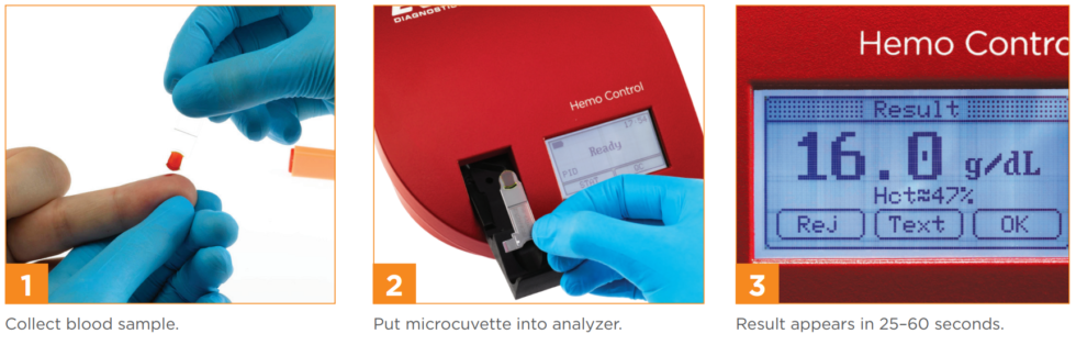 EKF Hemo Control - Avant Medical